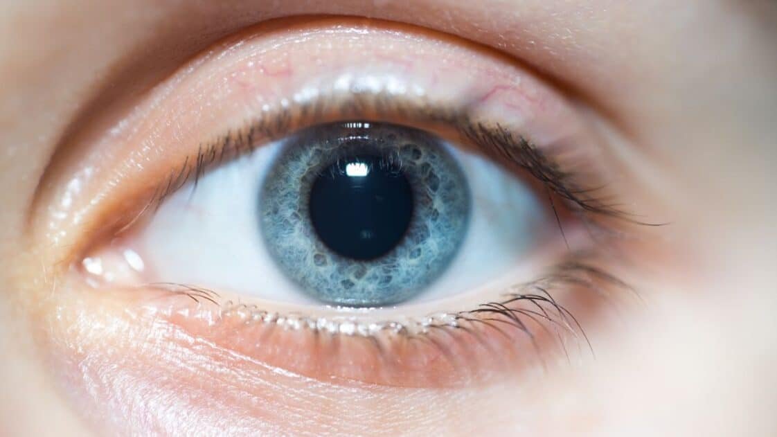 What Causes Dilated Pupils and How to Treat Them | Eye Pain Center