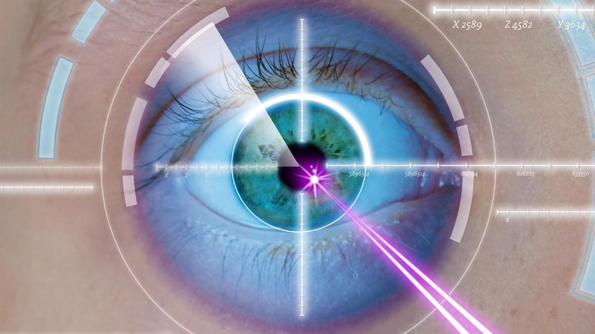 Everything You Need to Know About LASEK Eye Surgery