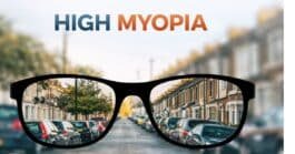 High Myopia: Causes, Risks, and How It’s Managed | Eye Pain Center