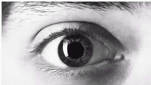 Eye Discharge: Causes, Treatment, and When to See a Doctor | Eye Pain ...